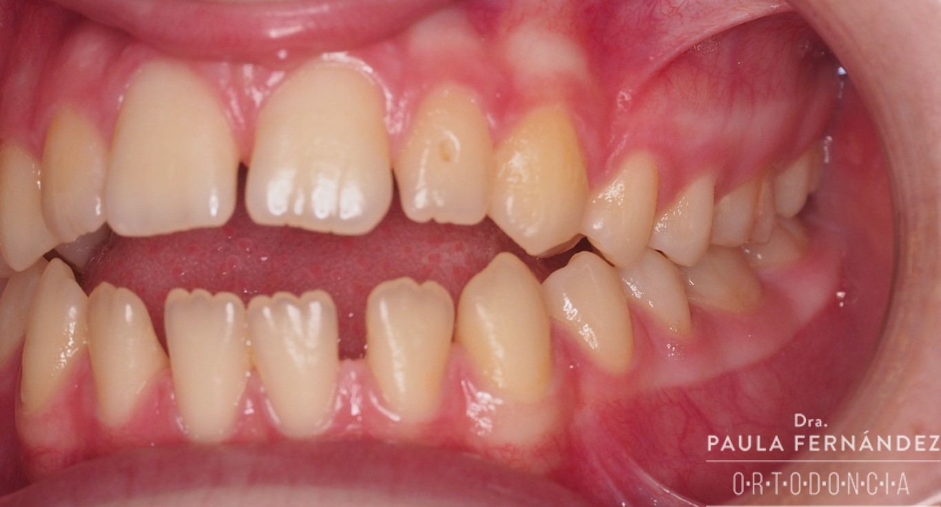 Mordida abierta | Paula Fernández Riveiro